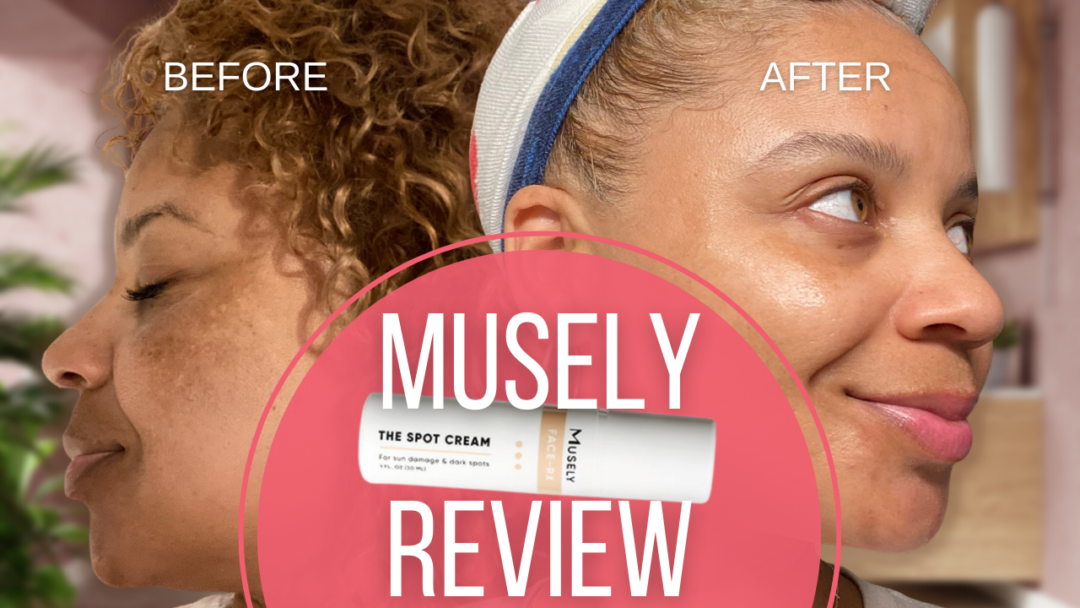 My Skincare Journey: How I Cleared My Melasma Using Musely – Teetothe ...