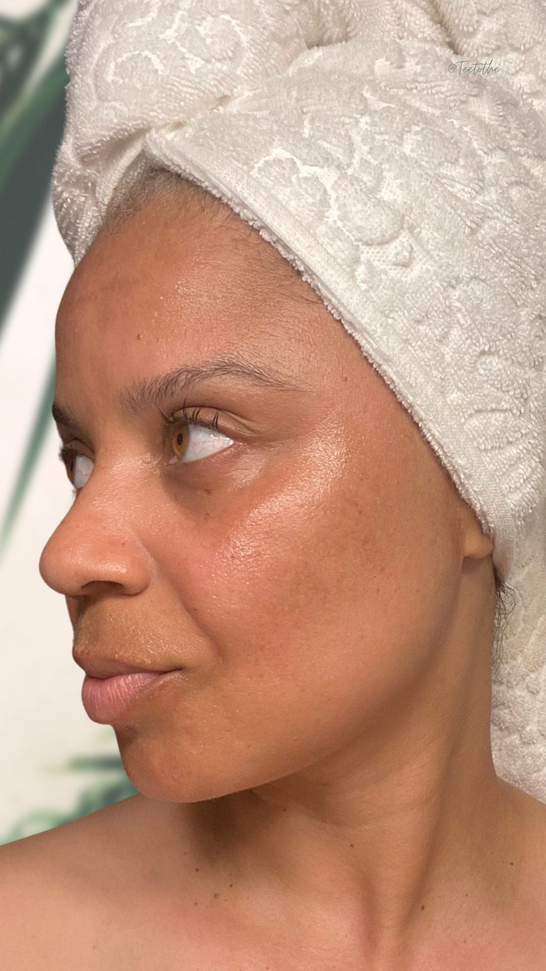 My Skincare Journey: How I Cleared My Melasma Using Musely – Teetothe ...